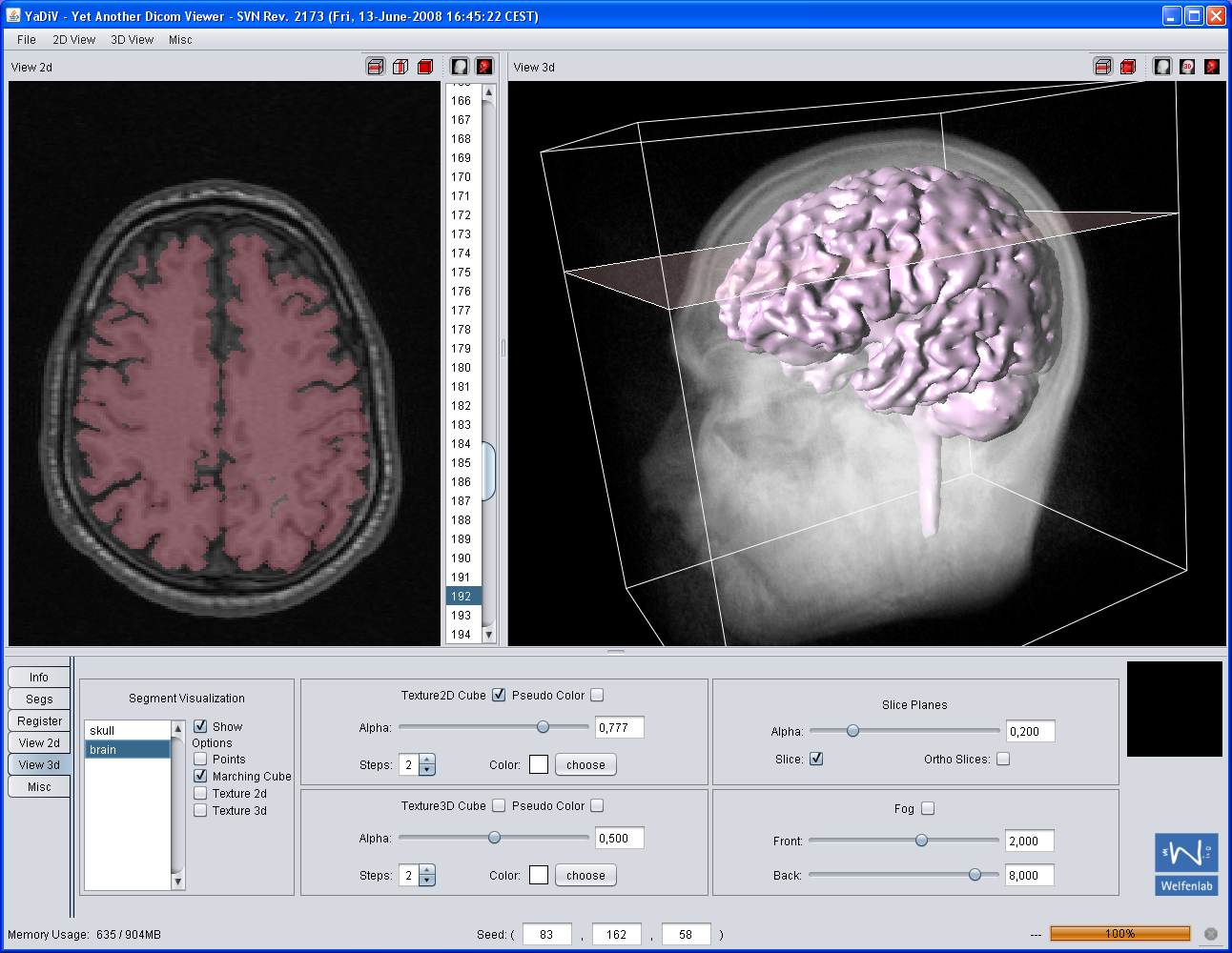 Java Display Dicom Or Raw Images In 3d Stack Overflow